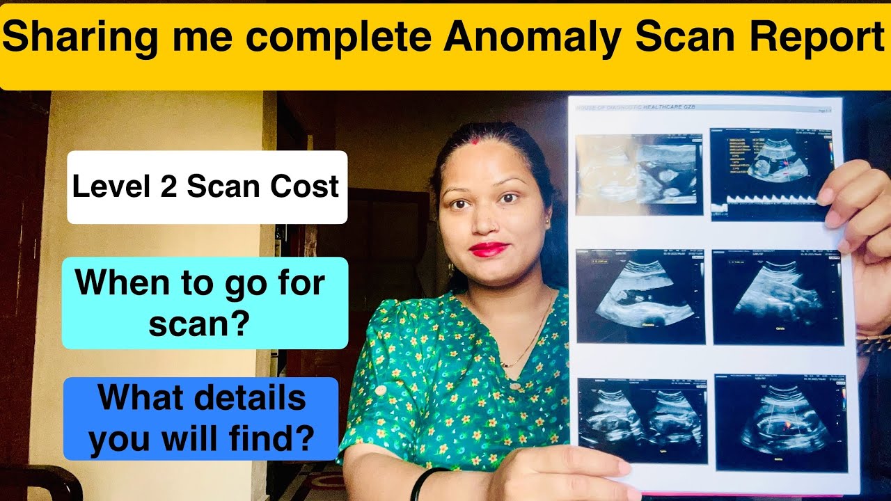 मेरी Anomaly Scan/level 2 scan की full Report-What to Expect/Why ...