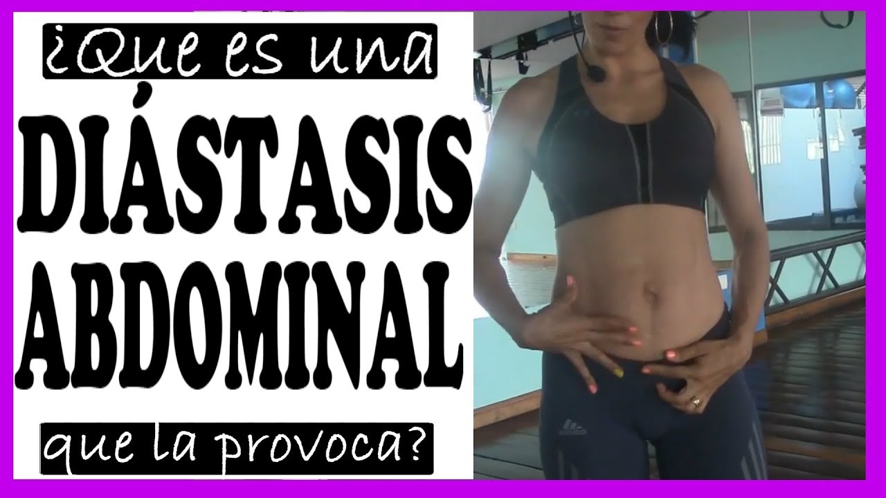 DiÁstasis Abdominal Mi Historia Y Rutina De Abdomen Plano En 1 Semana
