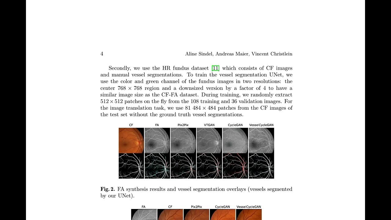 A Vessel-Segmentation-Based CycleGAN for Unpaired Multi-modal Retinal Image Synthesis - - YouTube