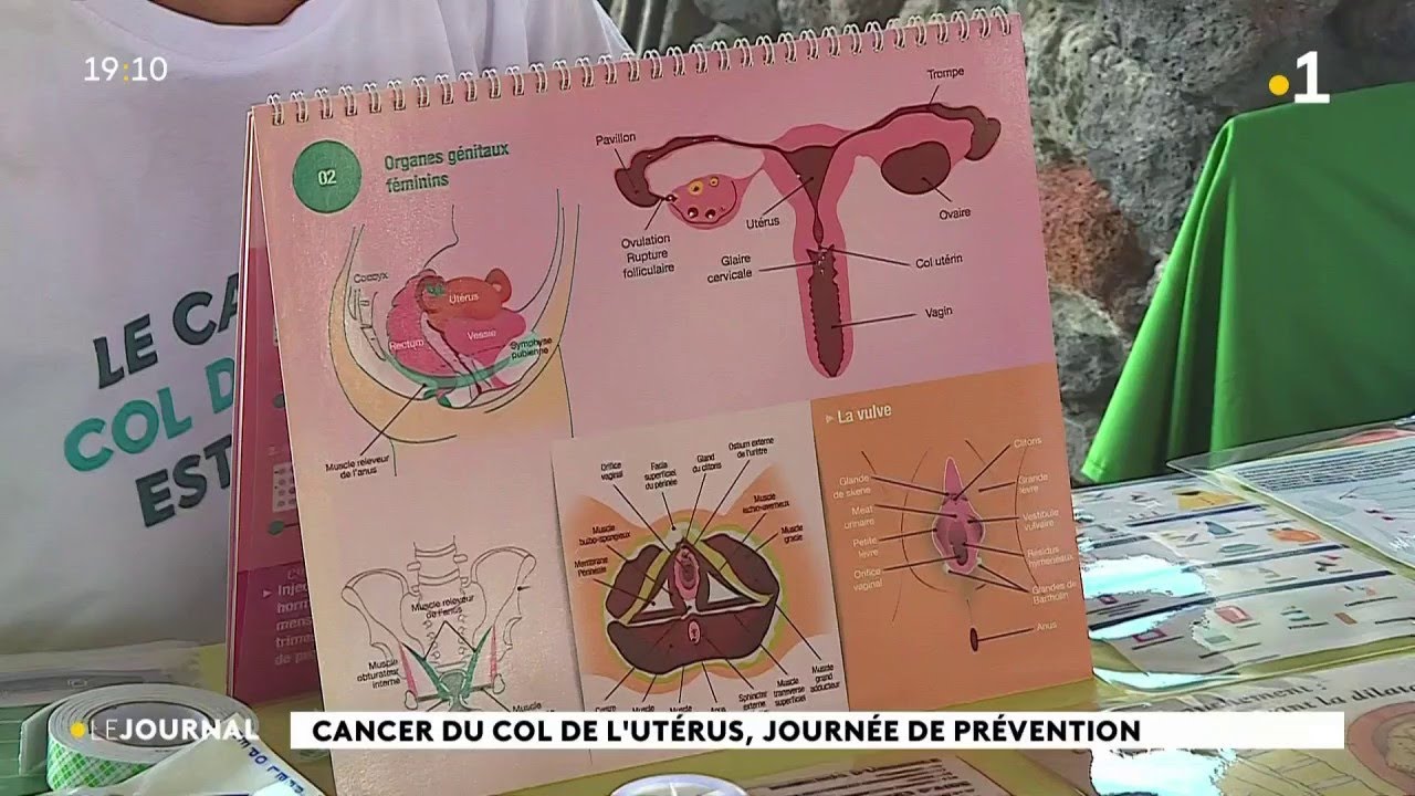 Cancer du col de l'utérus : sensibilisation et prévention pour sauver ...