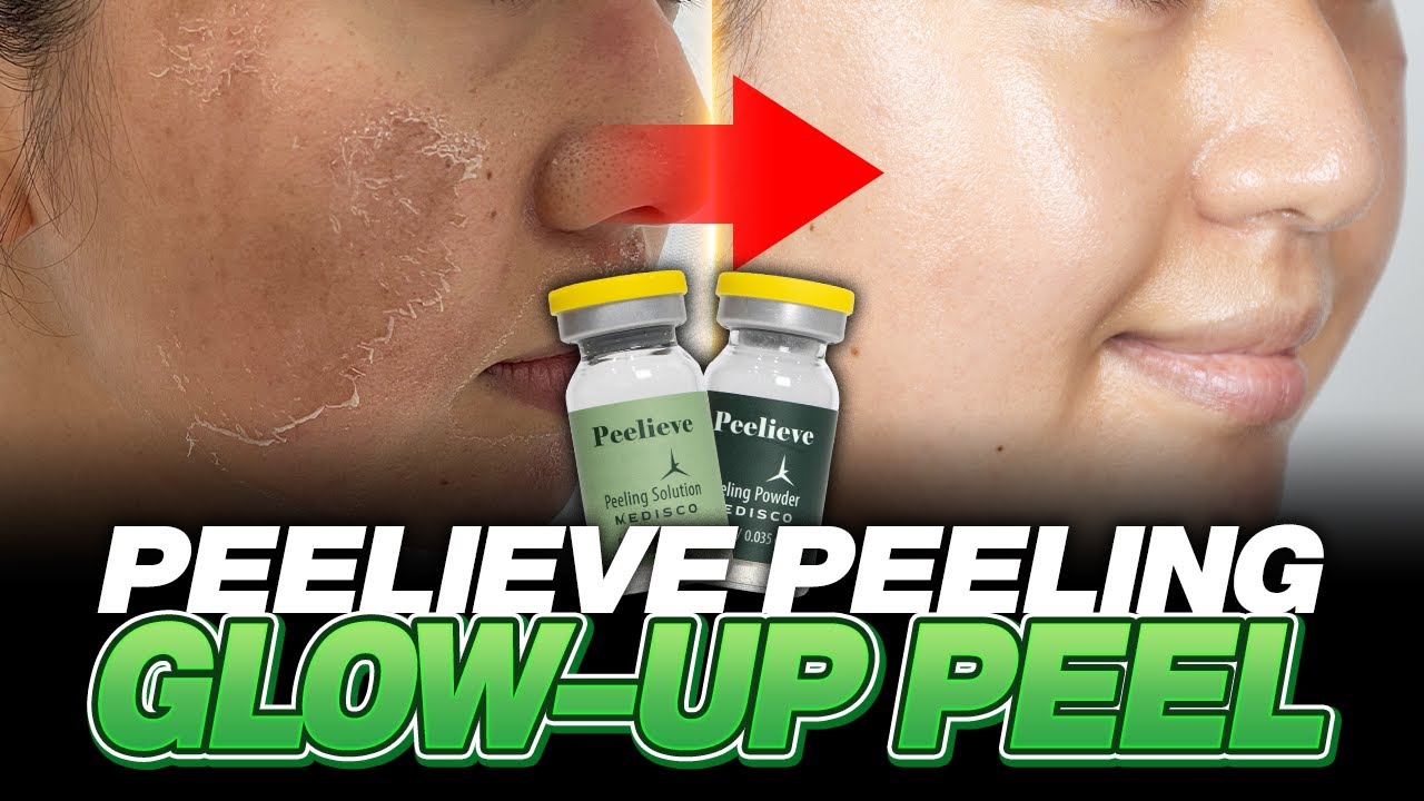 How to Apply Peeling at Home (Self-Treatment) - YouTube