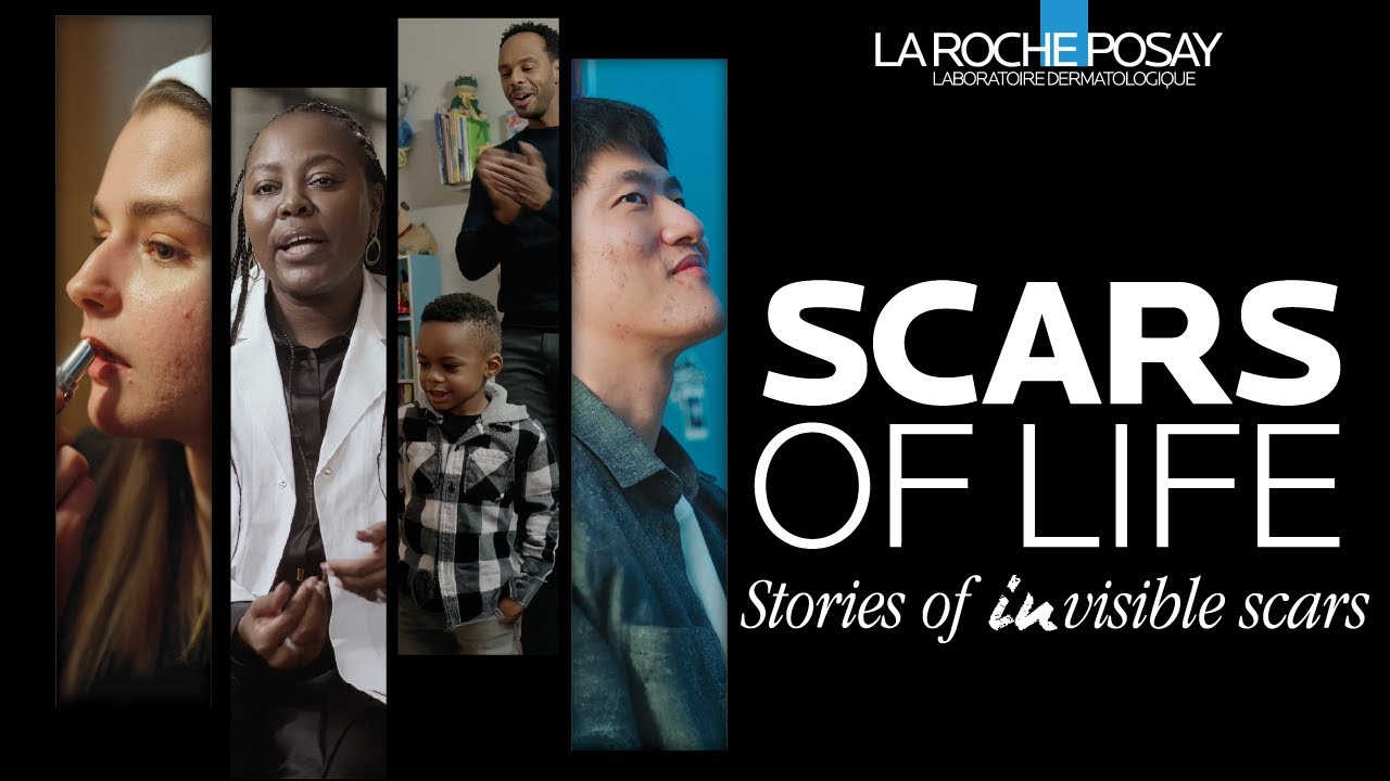 SCARS OF LIFE | Full Documentary | La Roche-Posay - YouTube