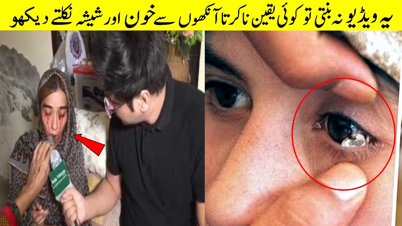 Crystals Pop up from Eyes When this Girl Cries | Unusual People With ...