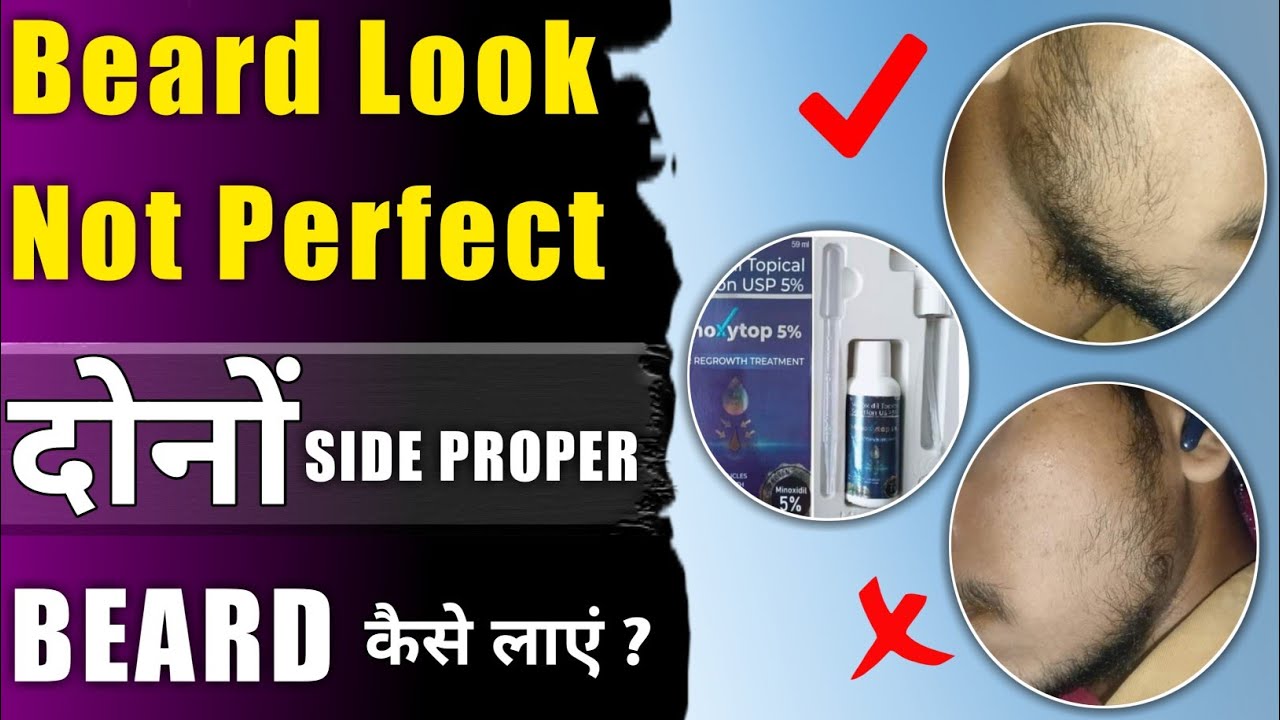 BEARD LOOK NOT PERFECT | दोनों SIDE PROPER BEARD कैसे लाएं ? We know ...