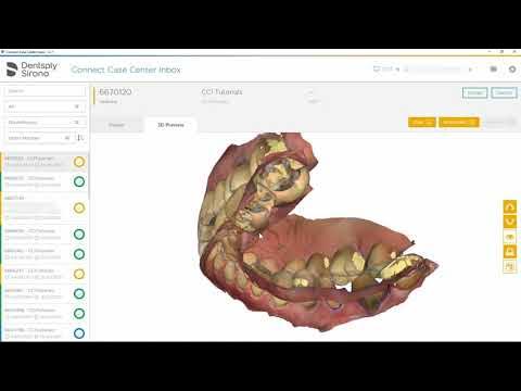 Workflow von Connect Case Center Inbox zu 3Shape: Vollkonturkronen und ...
