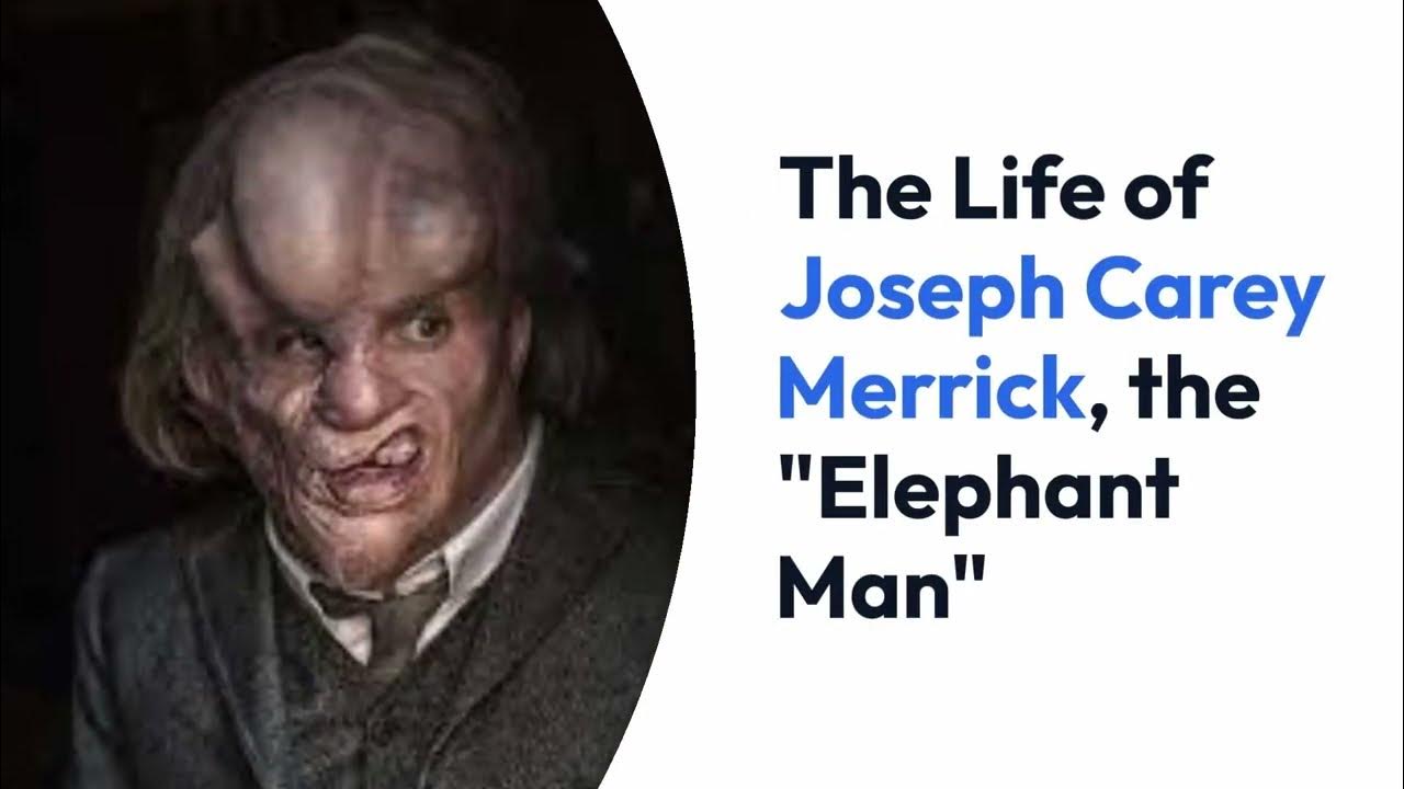 The story of Joseph Carey Merrick AKA the "Elephant Man" - YouTube