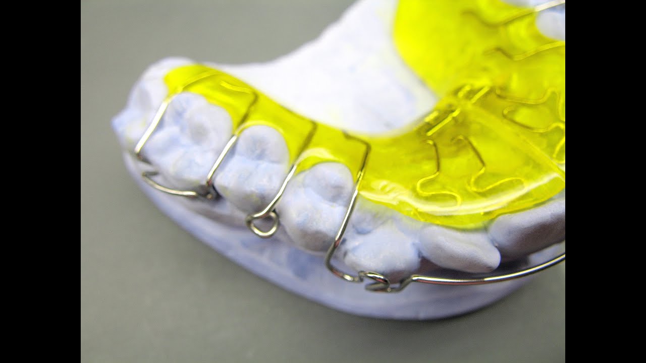 Herstellung einer Dehnplatte KFO Kieferorthopädie Orthodontics active ...