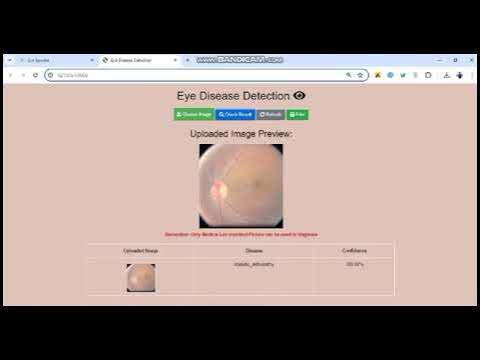 Cataract Disease Detection Using Deep Learning Final Year Project - YouTube