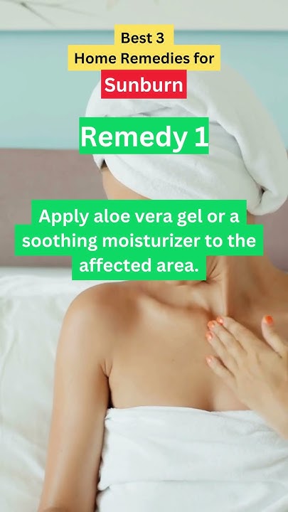 Best 3 Home Remedies For Sunburn Youtube