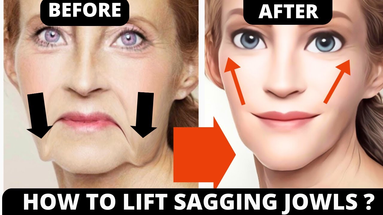 🛑 ANTI-AGING FACE LIFTING EXERCISES FOR SAGGING SKIN, JOWLS, LAUGH ...