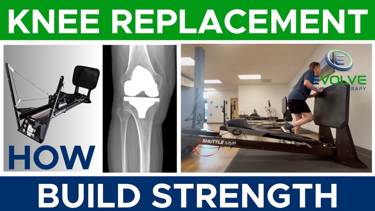 Total Knee Replacement | Improving Gluteal and Quadriceps Strength ...