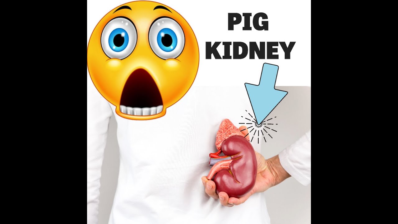 PIG KIDNEY IN A HUMAN? UNBELIEVABLE MEDICAL NEWS! #health #medical # ...