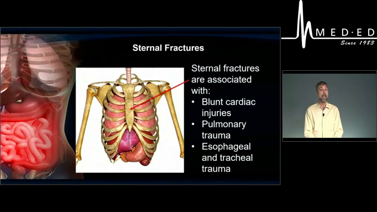 TCRN Exam Review 2nd Edition: Trunk: Thoracic Trauma MED-ED by Jeff ...