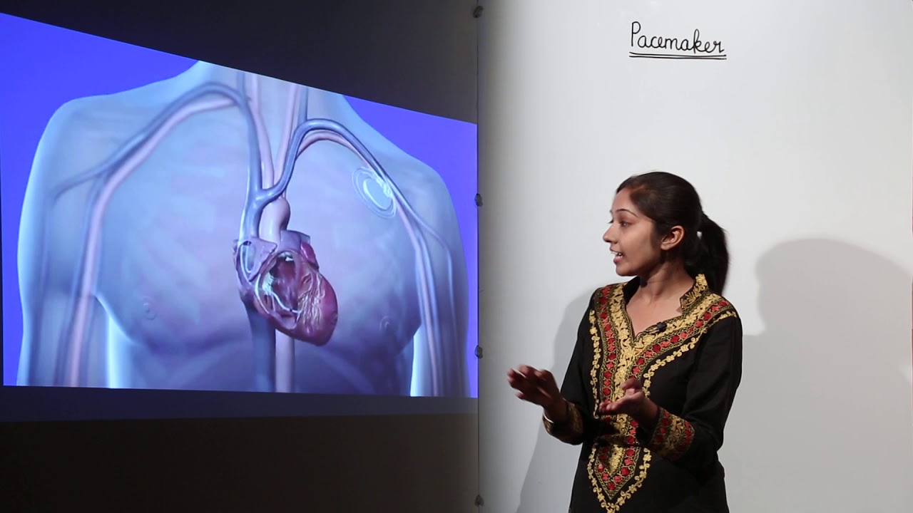 Pacemaker animation l ICSE l SECTION C l CLASS 12 BIOLOGY l BIOMEDICAL ...