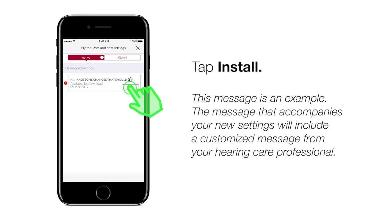 Resound Assist: How to accept and install new hearing aid program ...
