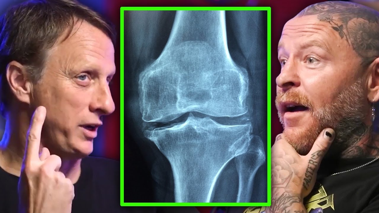 Tony Hawk On His Knee Injury, Traveling In Japan - YouTube