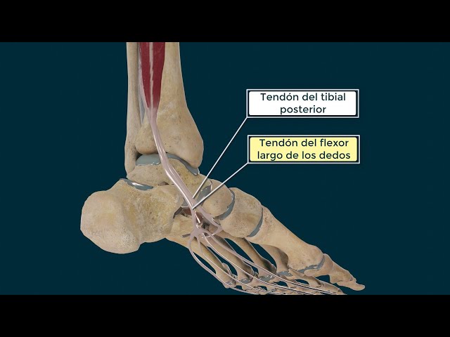 Aparato Ortopédico Para El Tendón Tibial Posterior