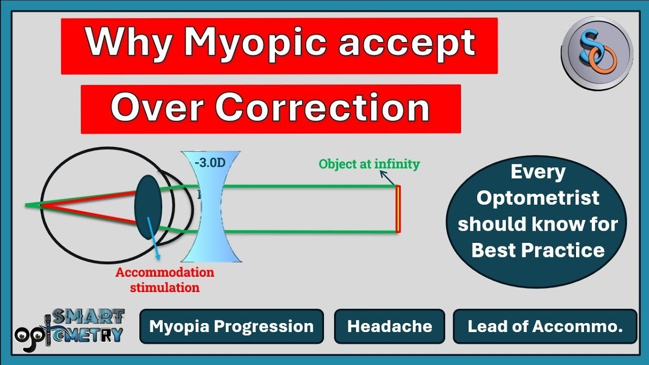 Why Myopic Patient accepts Over-correction easily during Refraction ...