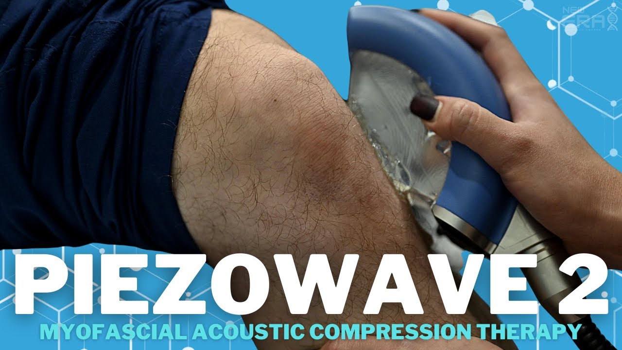 PIEZOWAVE 2: INTRODUCING OUR NEW MYOFASCIAL ACOUSTIC COMPRESSION ...