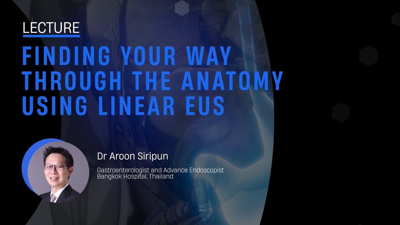 Finding your way through the Anatomy using Linear EUS (Dr. Aroon ...