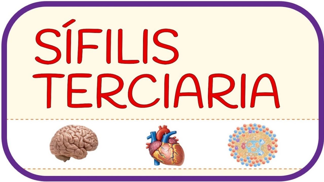 SÍFILIS TERCIARIA - Neurosífilis, sífilis caridiovacular, sífilis ...