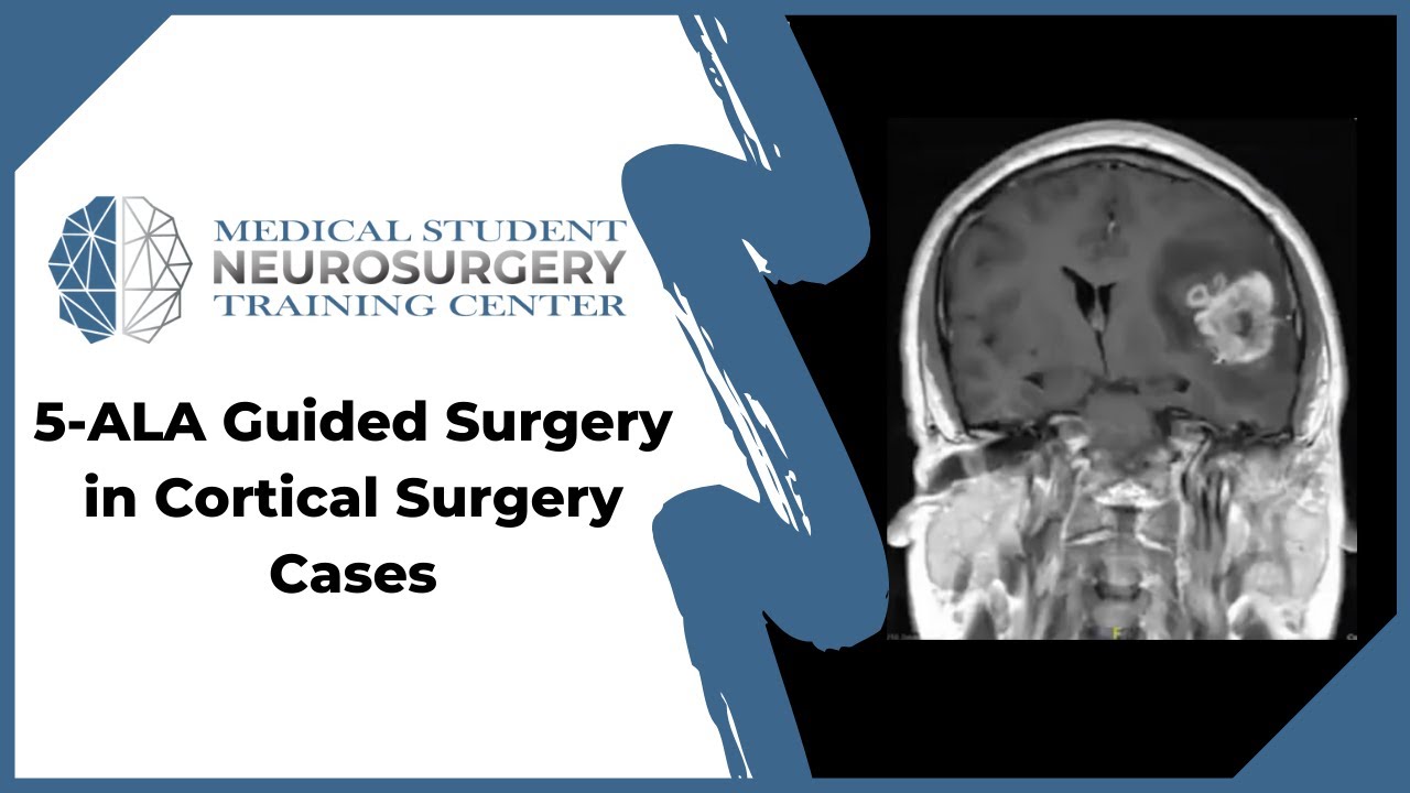 5-ALA Guided Surgery in Cortical Surgery Cases - YouTube