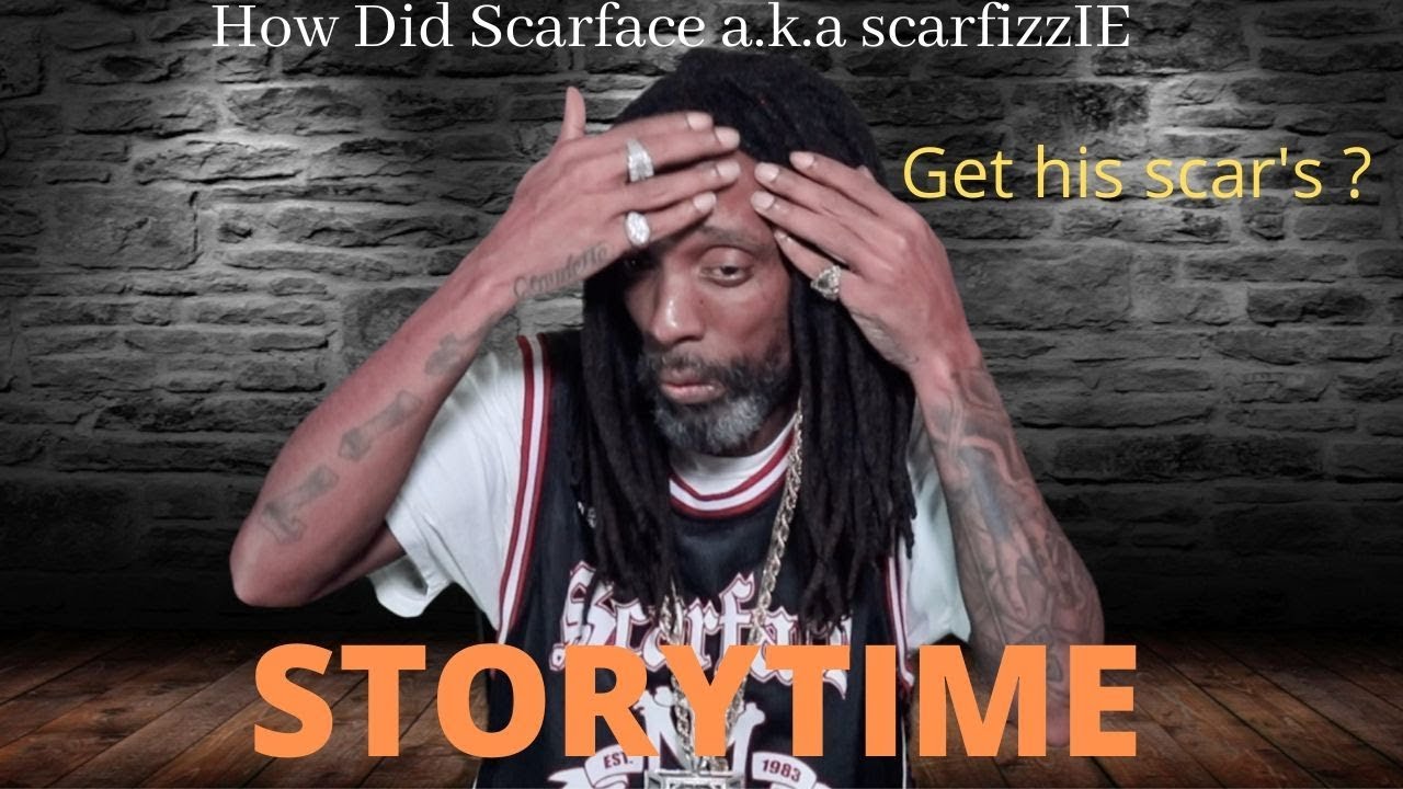 scarfizzIE StoryTime "How Did He Get His Scar's ?" - YouTube