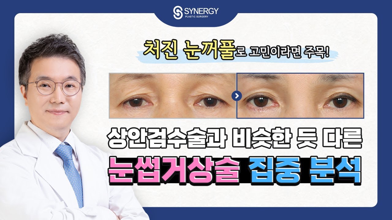 처진눈꺼풀 고민 상안검수술 대신 눈썹거상술로 이 영상 하나로 총정리🔍 Youtube