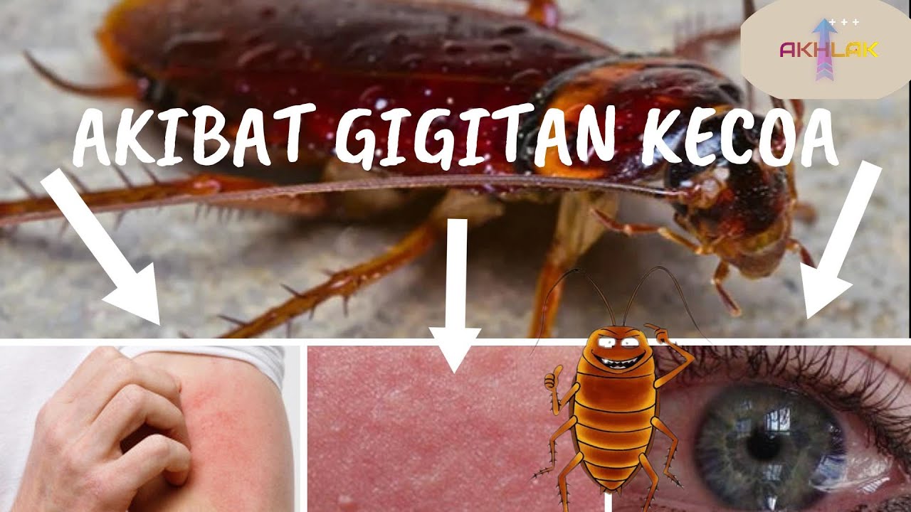 APAKAH KECOA MENGGIGIT ? INILAH DAMPAK GIGITAN KECOA - YouTube