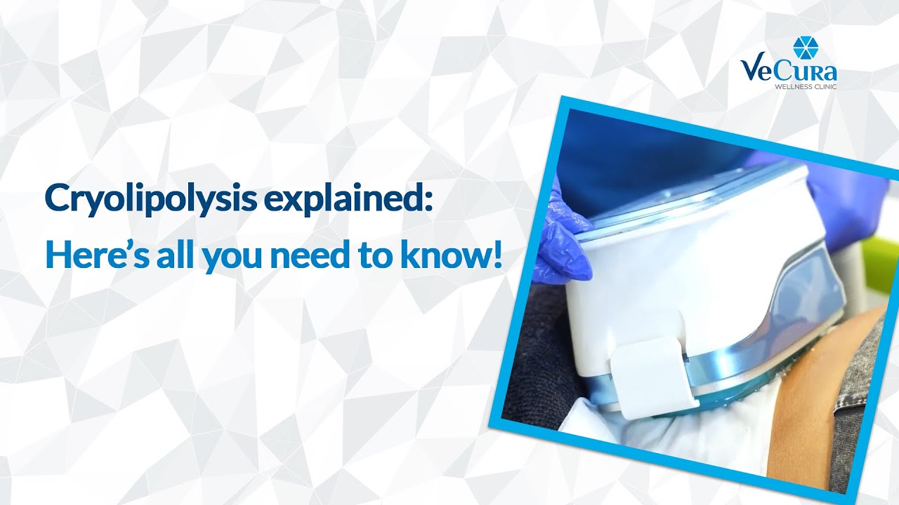 How does fat-freezing with Cryolipolysis work at VeCura wellness? - YouTube
