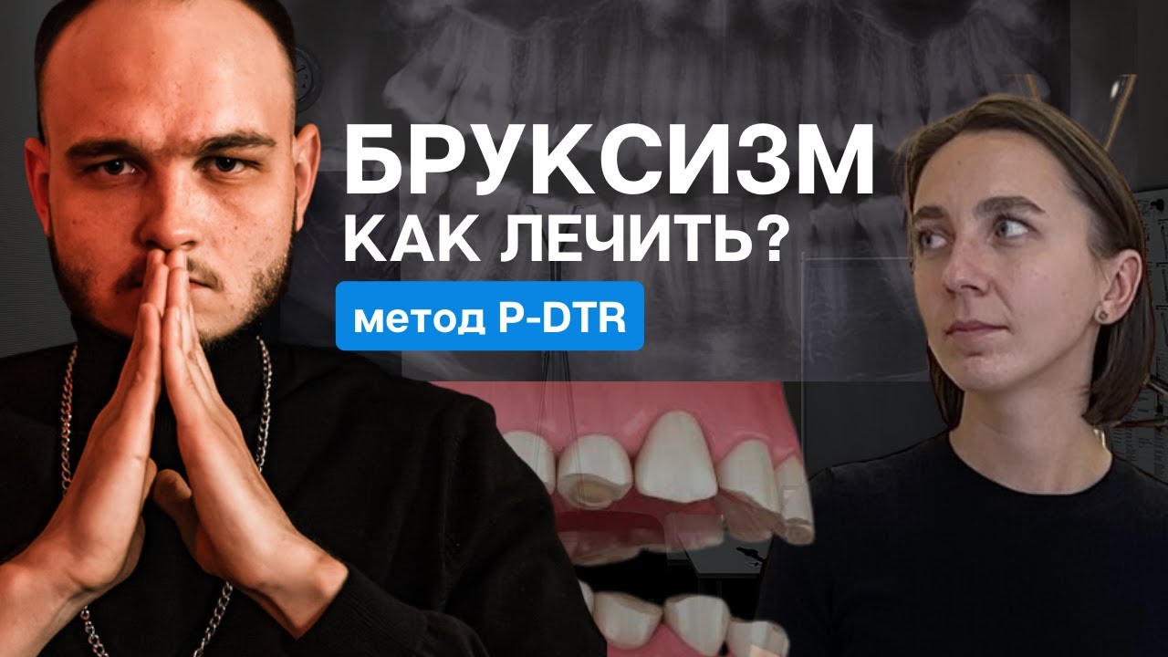БРУКСИЗМ. КАК ЛЕЧИТЬ? Причины бруксизма, современная терапия - YouTube