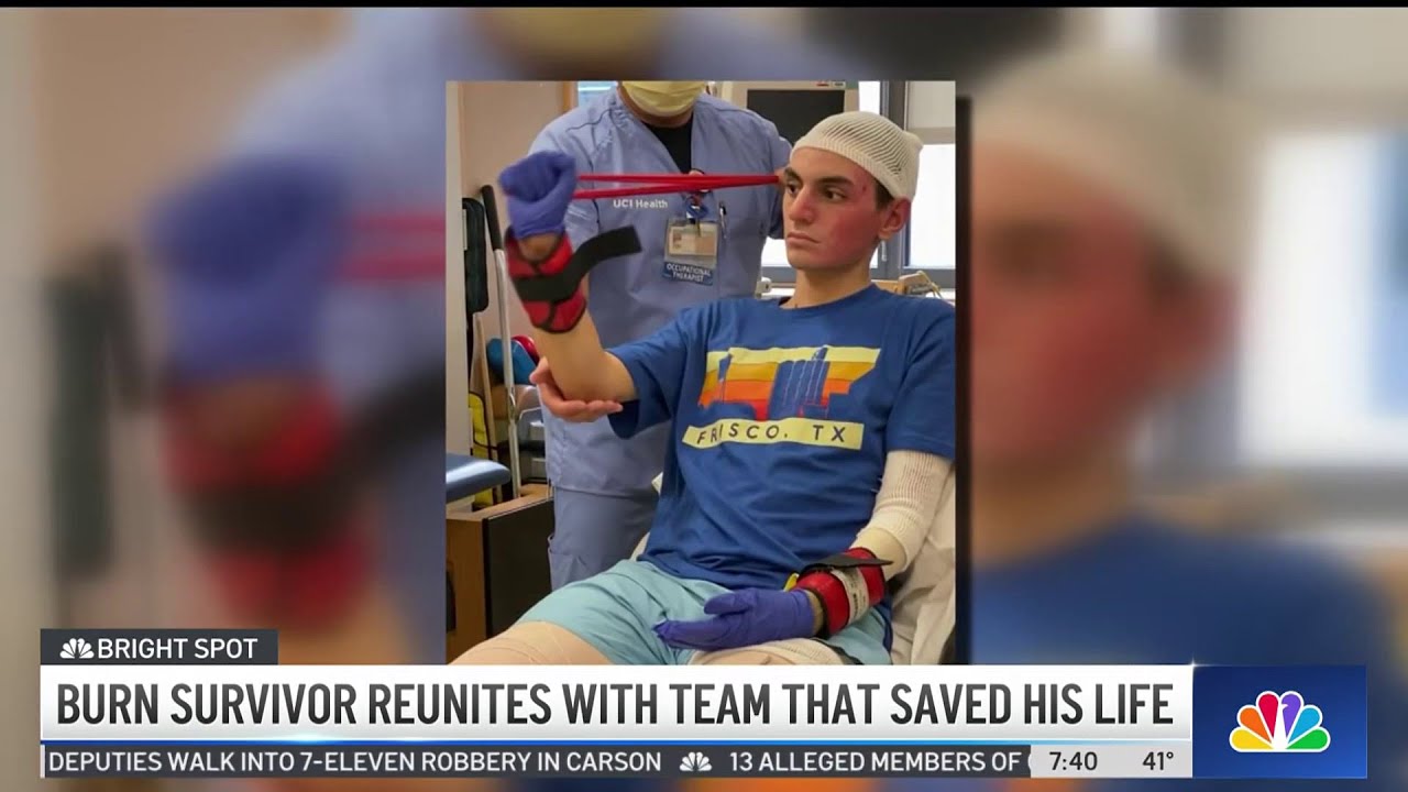 Burn survivor reunites with team that saved his life. - YouTube