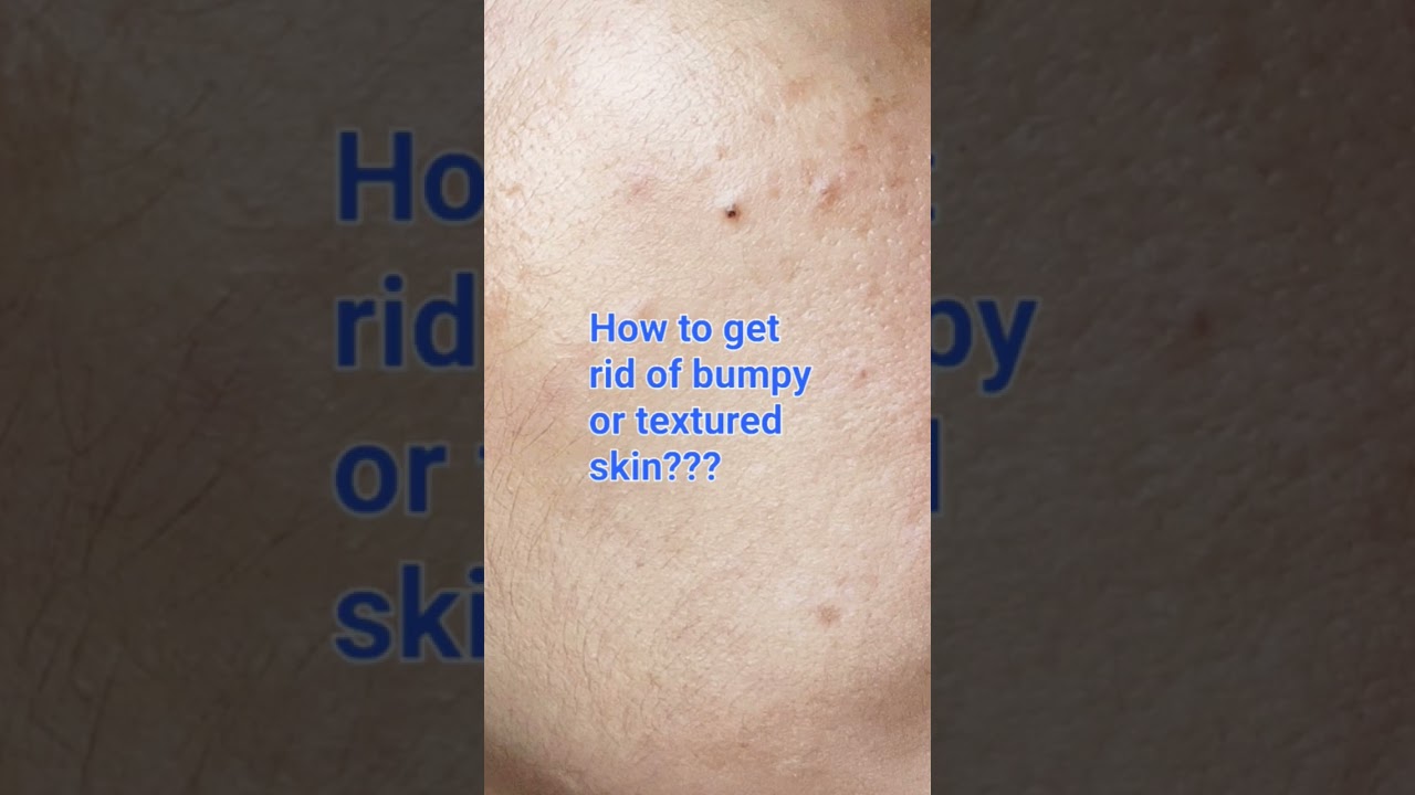 How to get rid of bumpy/textured skin??? - YouTube