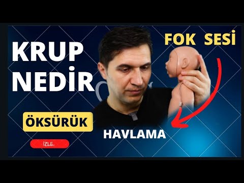 KRUP ÖKSÜRÜK NEDİR ? ÇOCUKLARDA VE BEBEKLERDE KRUP ÖKSÜRÜĞÜ NASIL GEÇER ?