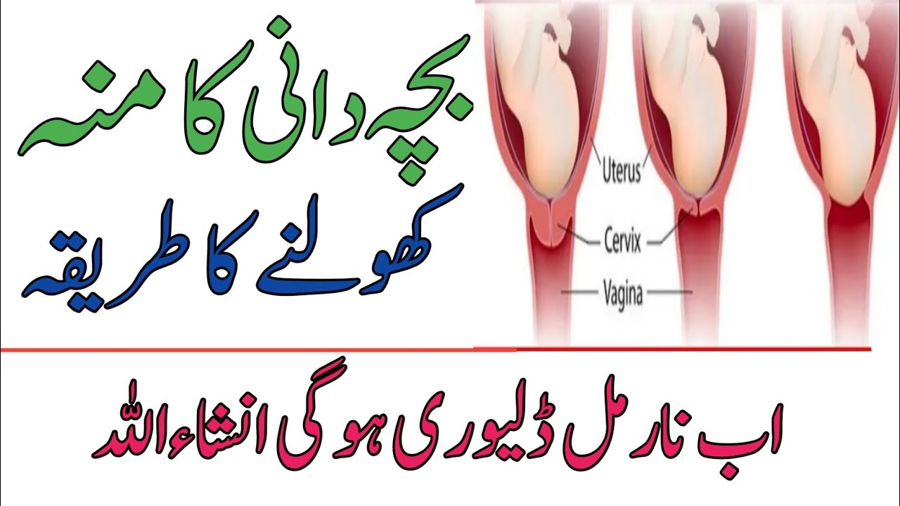 Bachedani ka muh kholne ka tarka|Bachedani ka muh jaldi kholne k lie ...