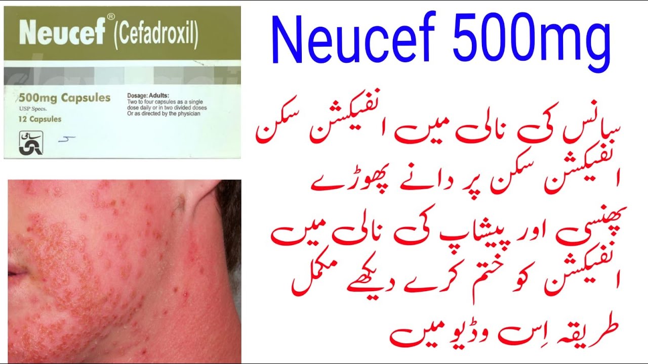 neucef 500mg capsule Cefadroxil Antibiotic Cephalosporin group ll جلد ...