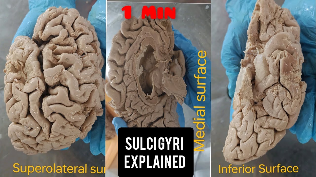 Sulci And Gyri Explained In 1 Minute !🤩 #bds - YouTube