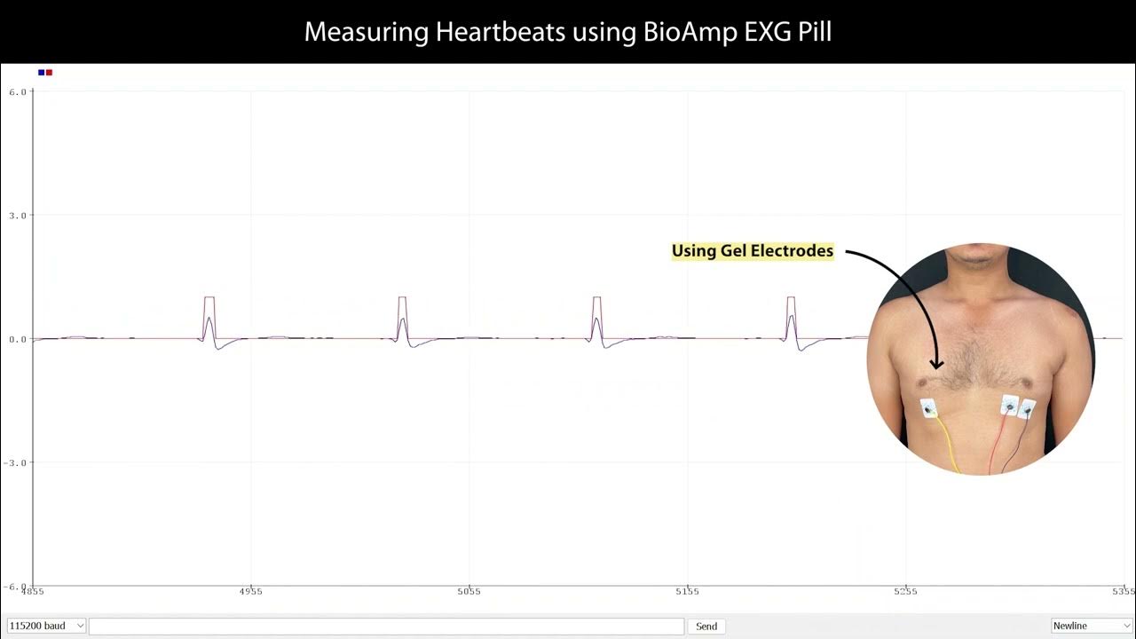 Heartbeat Detection using BioAmp EXG Pill | ECG | DIY Neuroscience Kit ...