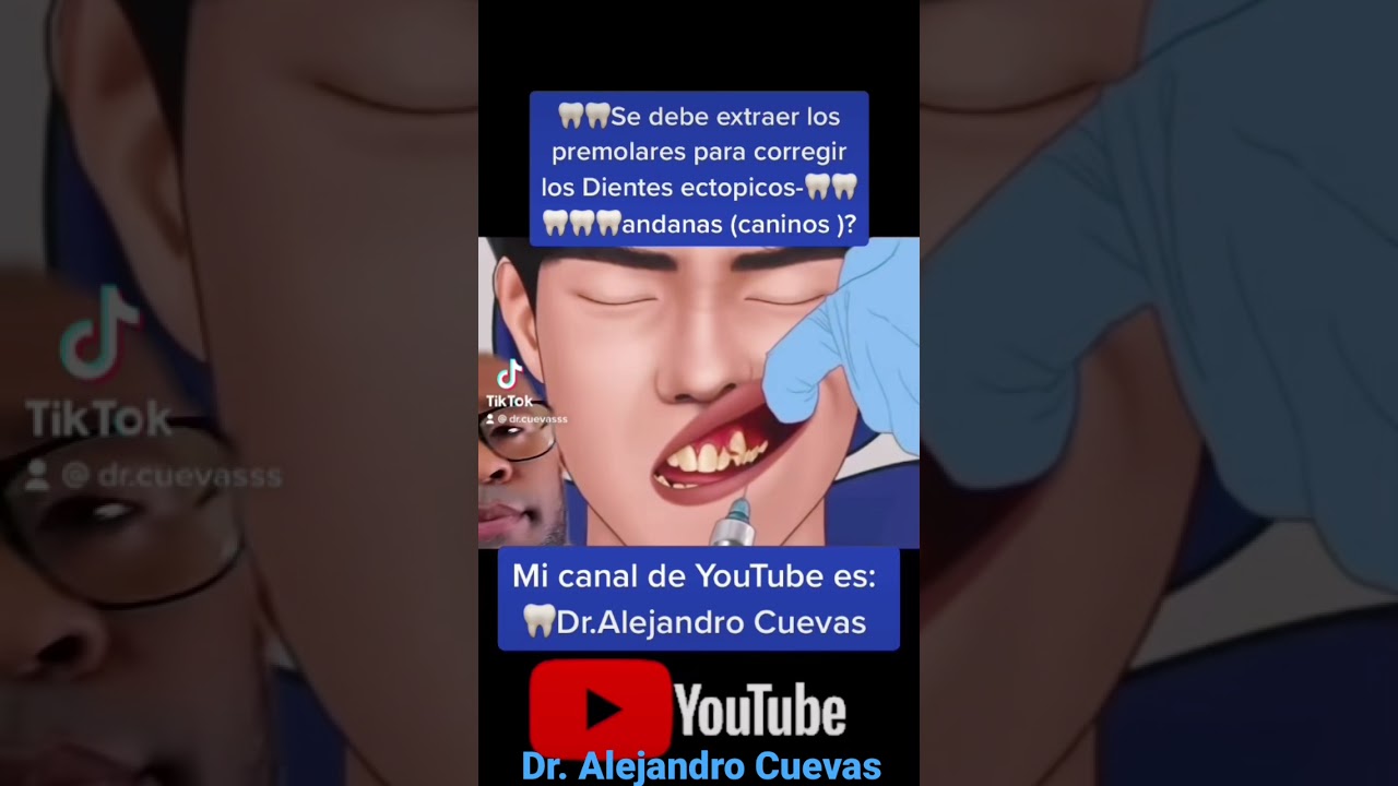 Que solución existe para loa dientes andanas o canino? #shorts #andana ...