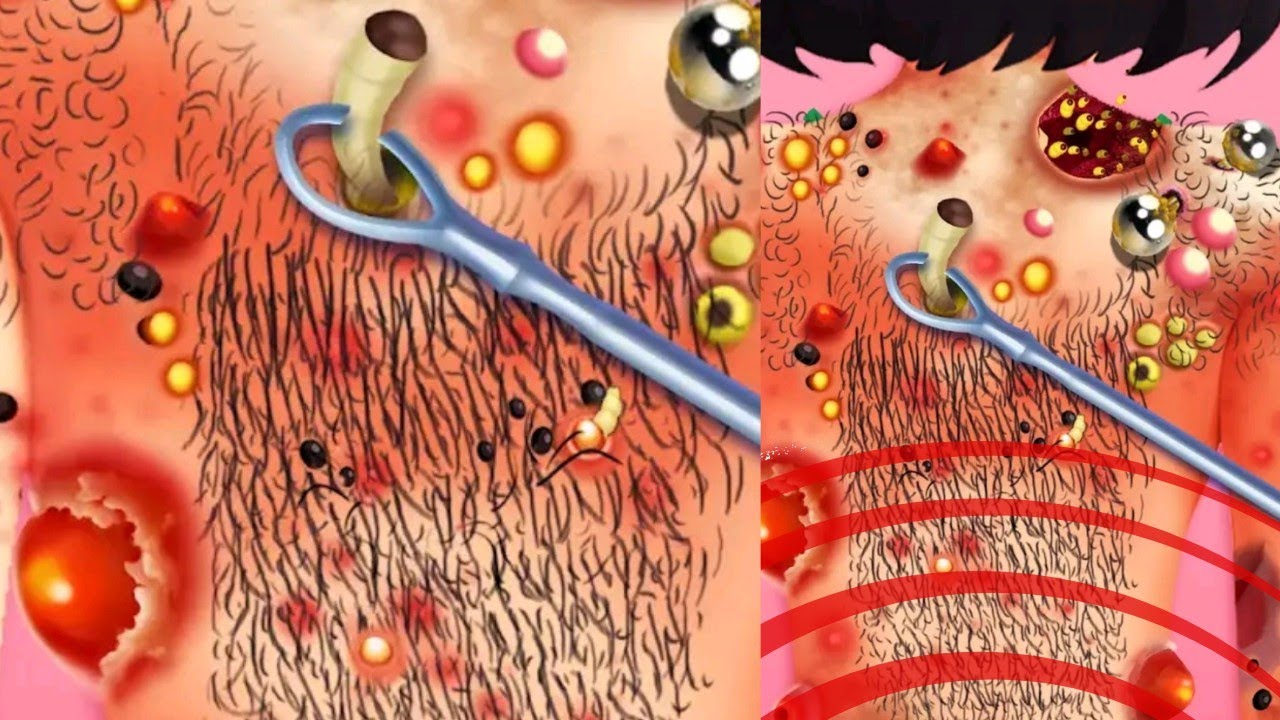 Help me with back pain asmr #asmr #tataasmr #a #asmrtreatment # ...