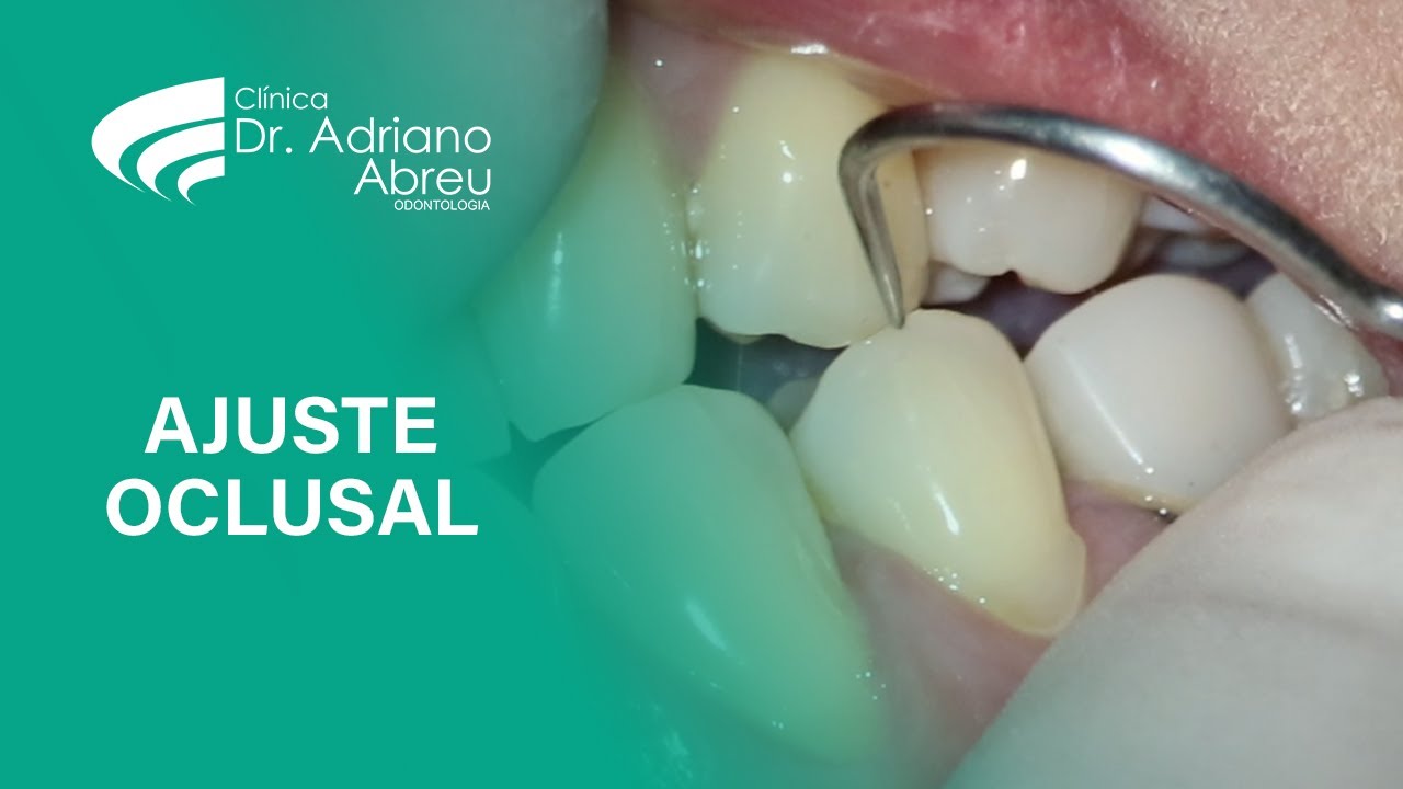 AJUSTE OCLUSAL - YouTube