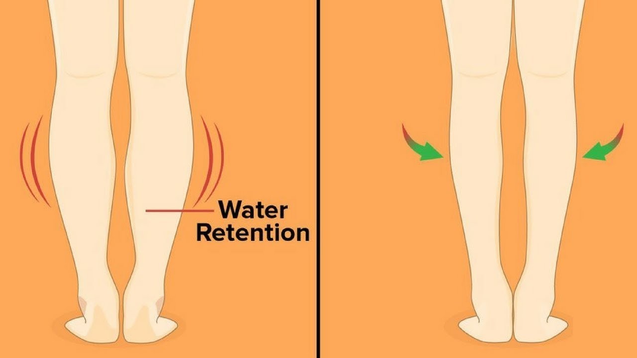 What Causes Water Retention and How to Avoid It - YouTube