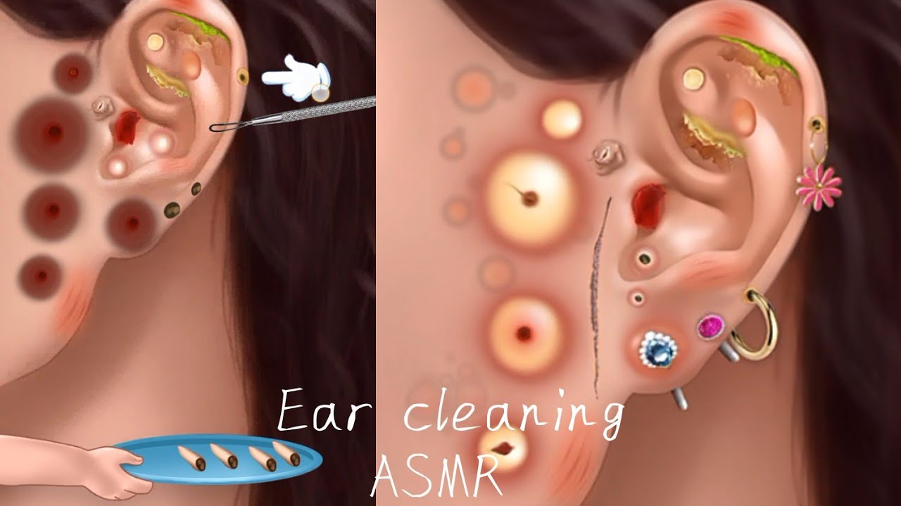 Ear cleaning ASMR 🧽| Relaxing asmr video 🤩 - YouTube