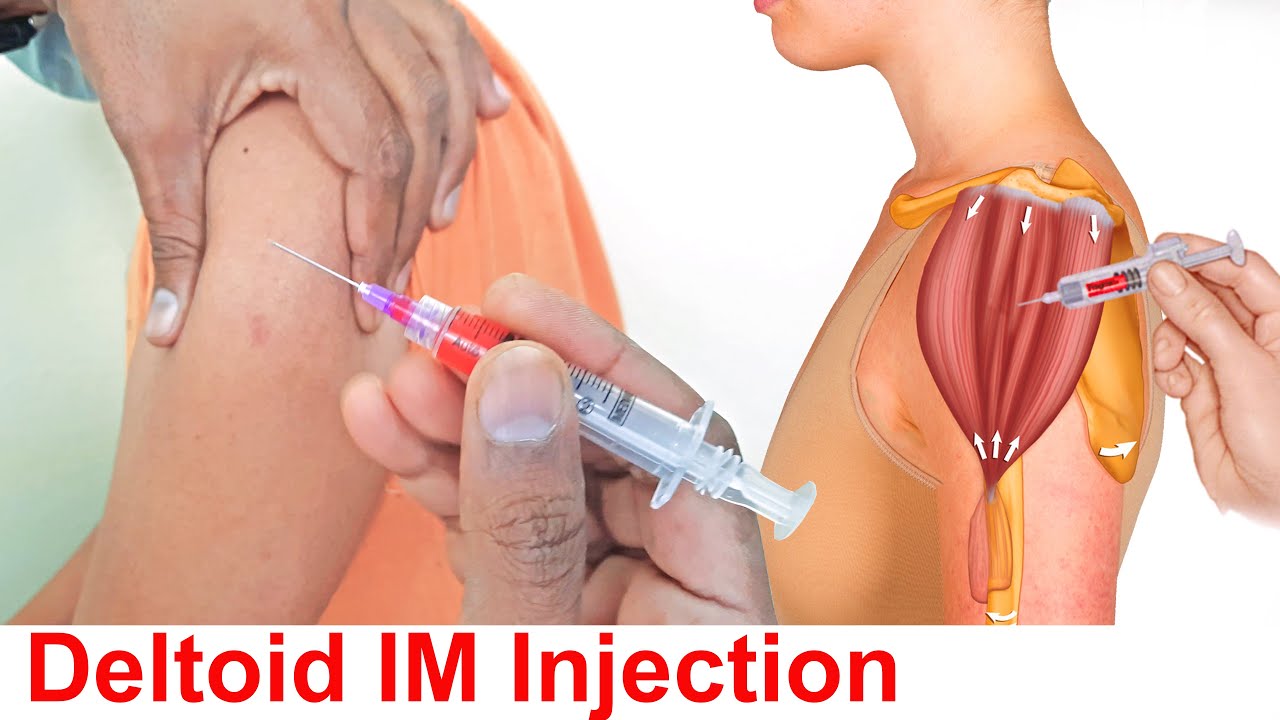 Deltoid Muscle Injection