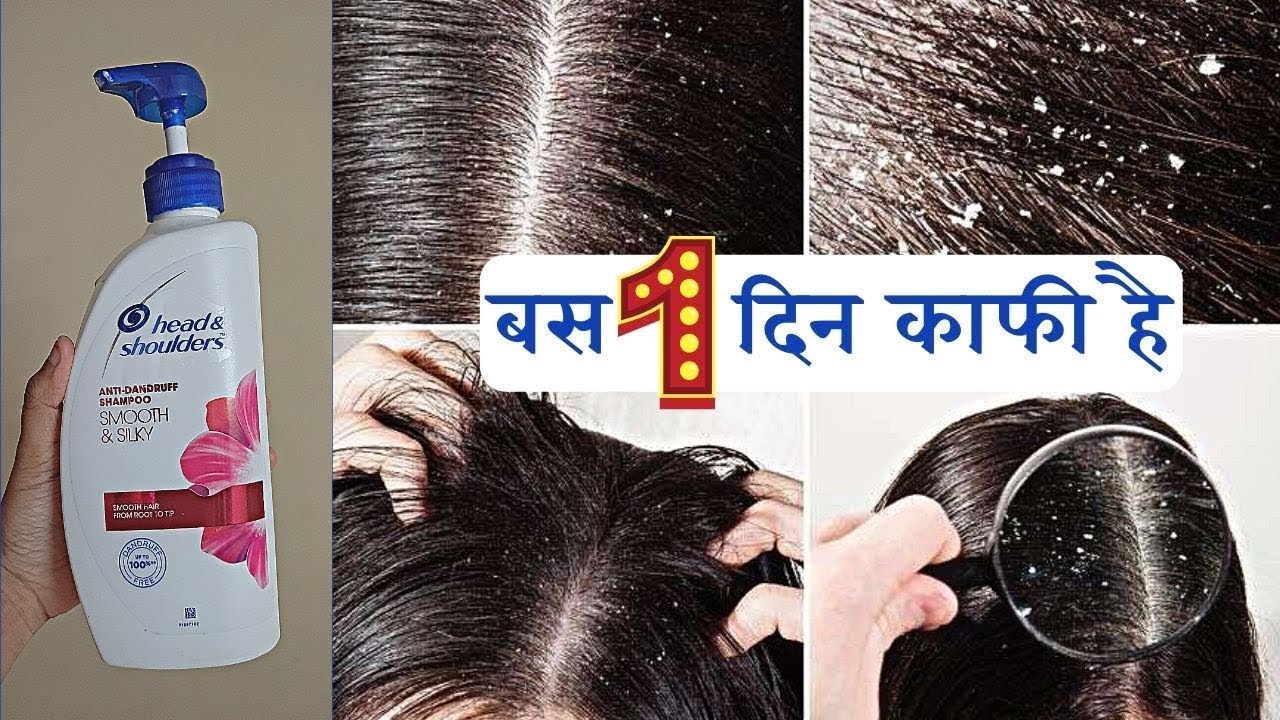 Head And Shoulders Shampoo Side Effects