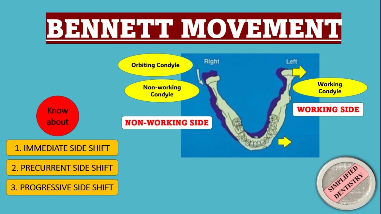 Bennett Movement And Its Classification Bennett Angle YouTube Bennett Movement And Its Classification Bennett Angle YouTube