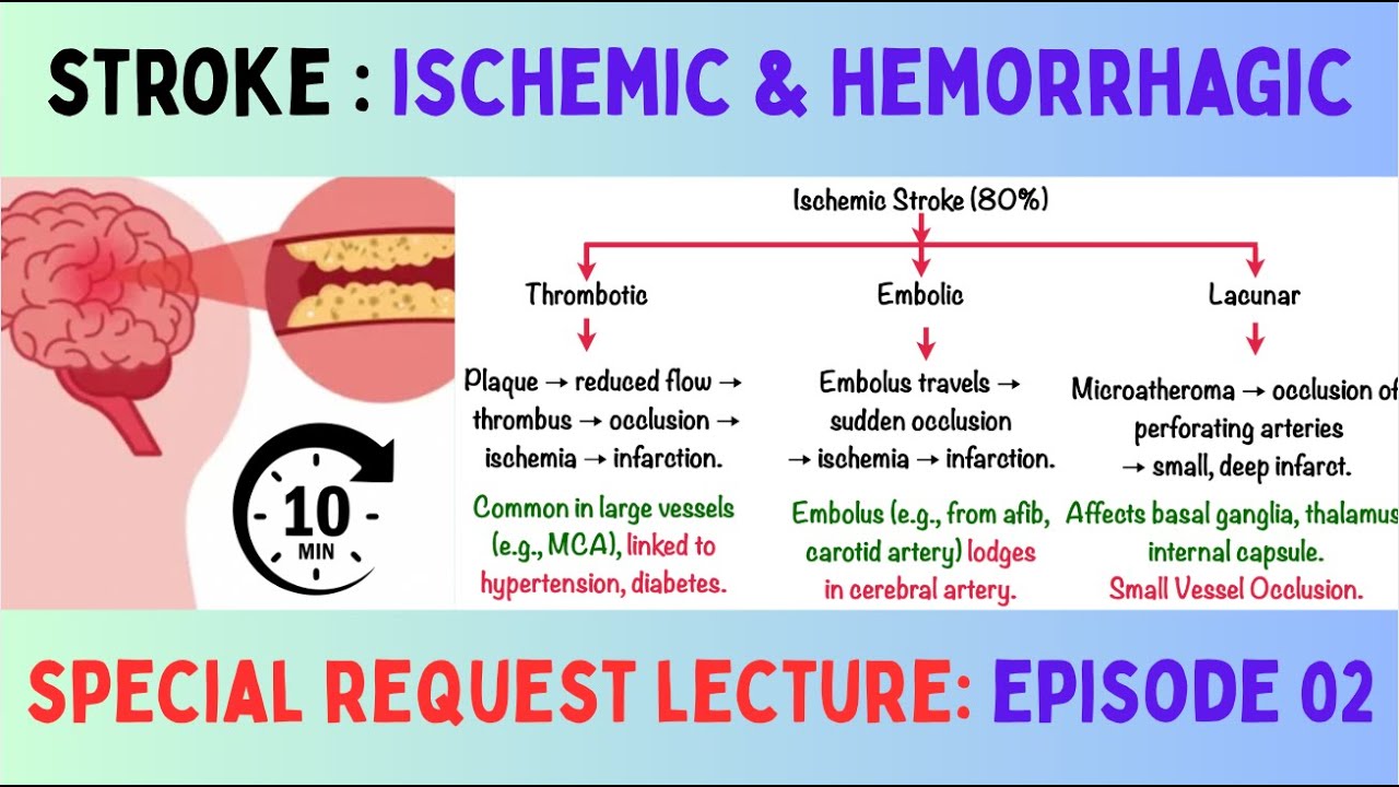 Ischemic & Hemorrhagic Stroke Explained: Symptoms, Pathophysiology & Treatment | MBBS Neurology ...