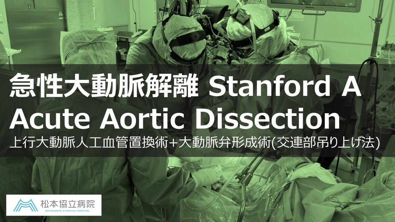 急性大動脈解離Stanford A/Acute Aortic Dissection - YouTube