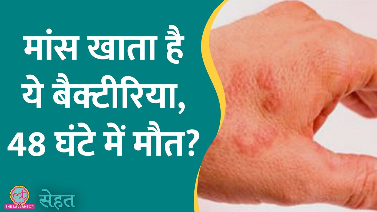 Japan में फैल रही अजीब बीमारी STSS क्या है, जो 'Flesh Eating Bacteria ...