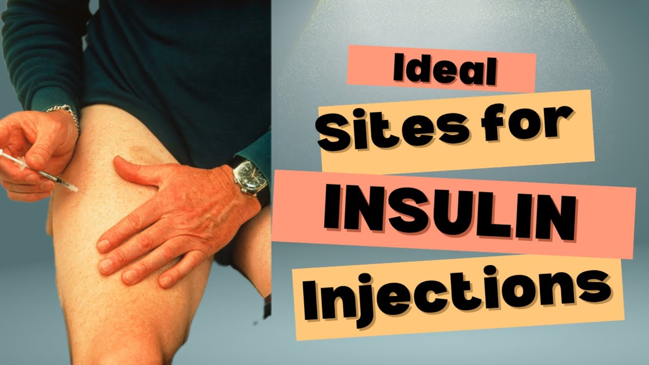 Insulin Injection Sites and Rotation - YouTube